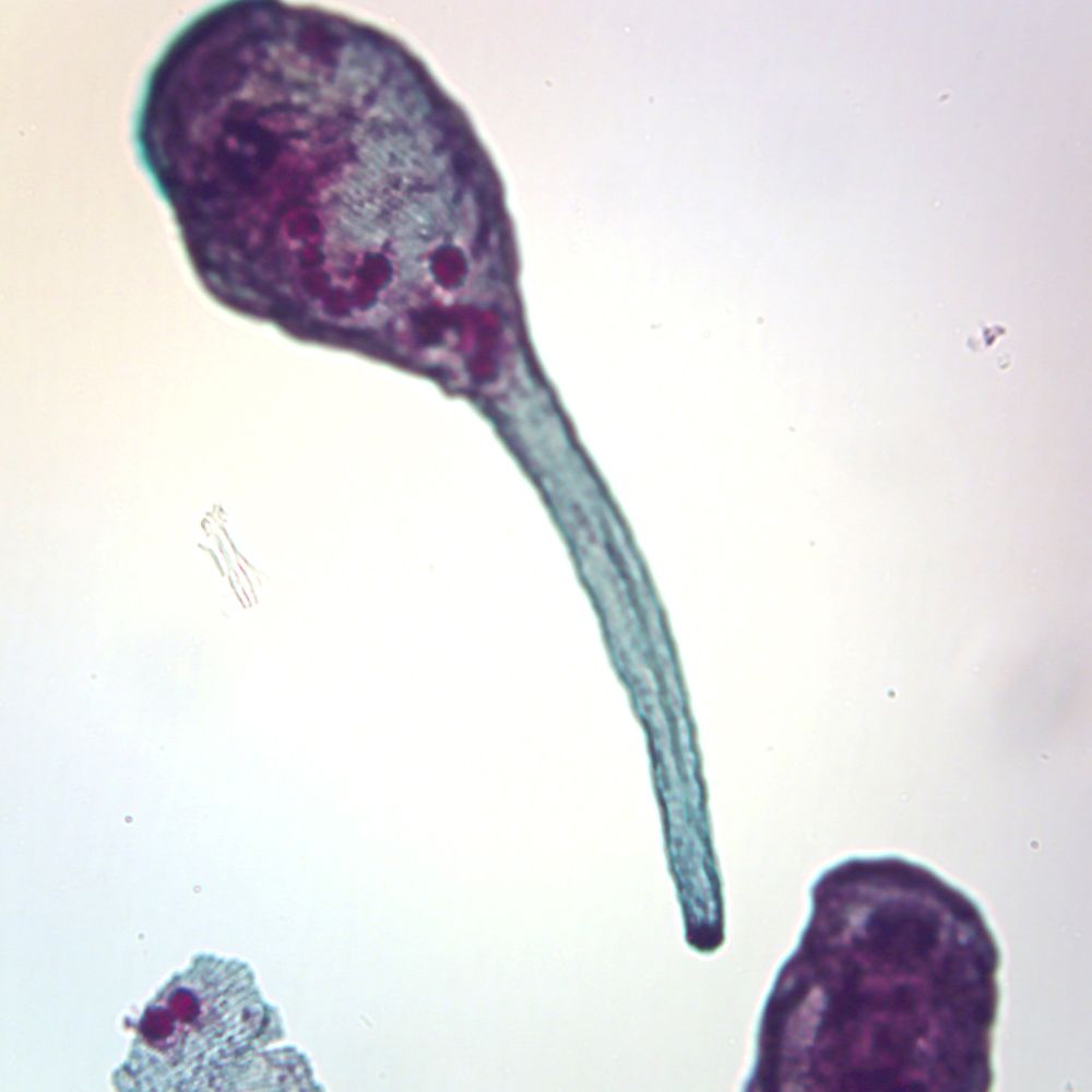 Stentor, w.m. Microscope Slide | Carolina.com