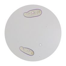 Colpidium striatum, Living | Carolina Biological Supply