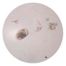 Euplotes, Living | Carolina Biological Supply