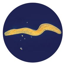 Spirostomum, Living | Carolina Biological Supply