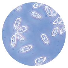 Chilomonas, Living | Carolina Biological Supply