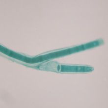 Tolypothrix, Living | Carolina Biological Supply