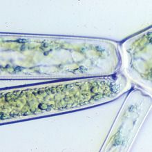 Cladophora, Living | Carolina Biological Supply