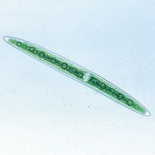 Closterium, Living | Carolina Biological Supply