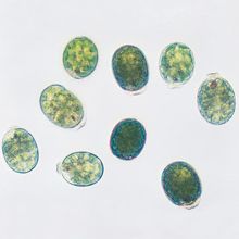 Euglenoids | Carolina Biological Supply