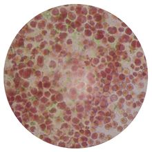 Porphyridium, Living | Carolina Biological Supply