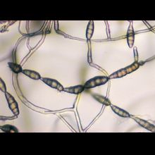 Allomyces arbuscula, Living, Tube | Carolina Biological Supply