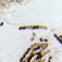 Sordaria fimicola Wild Type, Living, Plate | Carolina Biological Supply