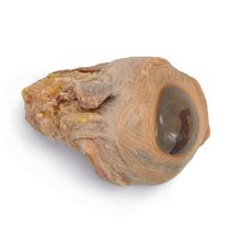 Formalin Preserved Pig Eye, Plain, Bulk Bag | Carolina Biological Supply