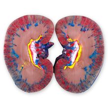 Carolina's Perfect Solution® Sheep Kidney, Triple Injection, 1 Per Bag ...