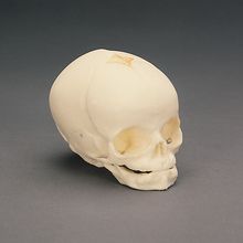 3B® Human Fetal Skull | Carolina Biological Supply