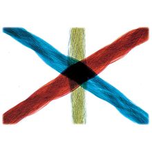 Colored Threads Slide, w.m. | Carolina Biological Supply