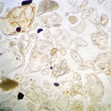 Sand Slide, w.m. | Carolina Biological Supply