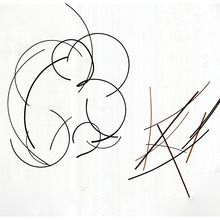 Human Straight and Curly Hair, w.m. Microscope Slide | Carolina ...