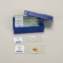 Flatworm and Roundworm Eggs Microscope Slide Set | Carolina Biological ...