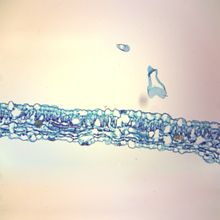 Tobacco Mosaic Virus, Microscope Slide | Carolina Biological Supply