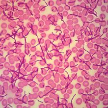 Bacteria and Blood, w.m. Microscope Slide | Carolina Biological Supply