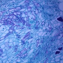 Crown Gall, sec., 12 µm Microscope Slide | Carolina Biological Supply