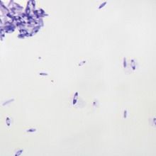 Clostridium Botulinum, perfringens, tetani, spores Microscope Slides, w ...