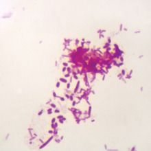 Pseudomonas aeruginosa, w.m. Microscope Slide | Carolina Biological Supply