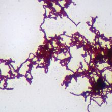 Treponema, w.m. Microscope Slide | Carolina Biological Supply
