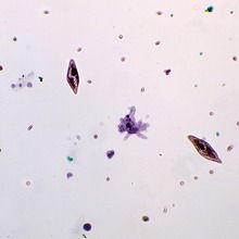 Mixed Protists Microscope Slides (mixed protozoa, dinoflagellates), w.m ...