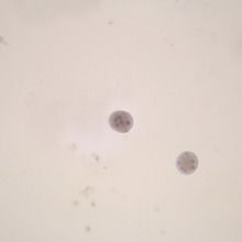 Entamoeba coli, Smear, Microscope Slides | Carolina Biological Supply