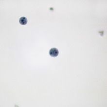 Entamoeba histolytica Cysts, smear Microscope Slide | Carolina ...