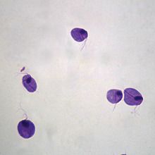 Trichomonas vaginalis Slide, Smear | Carolina Biological Supply