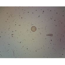 Diatomaceous Earth, w.m. Microscope Slide | Carolina Biological Supply