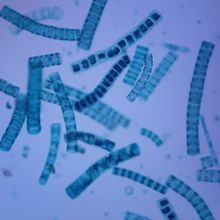 Ulothrix, w.m. Microscope Slide | Carolina Biological Supply