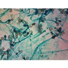 Allomyces Sporophyte, w.m. Microscope Slide | Carolina Biological Supply