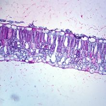 Lilac Mildew, section Microsphaera, Microscope Slide | Carolina ...