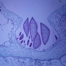 Anthoceros Mature Sporophyte, l.s., 12 µm Microscope Slide | Carolina ...