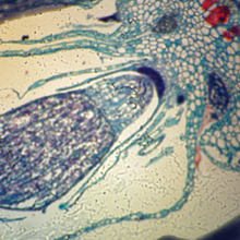 Marchantia Sporophyte, l.s., 12 µm Microscope Slide | Carolina ...