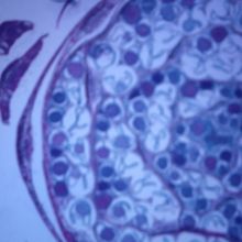 Polytrichum (Moss) Leaves, c.s., 12 µm Microscope Slide | Carolina ...