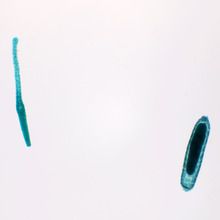 Moss Antheridia and Archegonia, w.m. Microscope Slide | Carolina ...