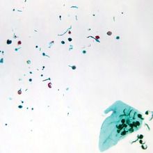 Fern Sori, w.m. Microscope Slide | Carolina Biological Supply