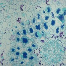 Fungi Demonstration Microscope Slides | Carolina Biological Supply