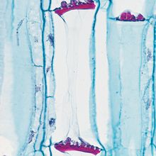 Pumpkin Stem, l.s., 12 µm Microscope Slide | Carolina Biological Supply