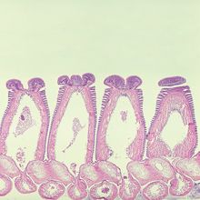 Starfish Ray (Arm), c.s. 7 µm H&E Microscope Slide | Carolina ...