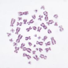 Human Chromosome Microscope Slides | Carolina Biological Supply