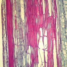 Sunflower Older Stem, l.s., 12 µm Microscope Slide | Carolina ...