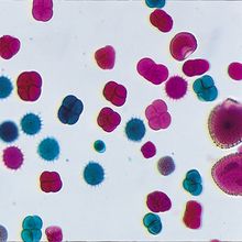 Lily Anther, Early Prophase of Meiosis, c.s., 12 µm Microscope Slide ...