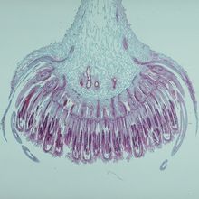 Flowers, Fruits, and Seeds Microscope Slide Set | Carolina Biological ...