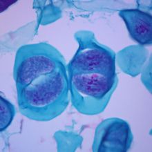 Lily Anther Second Meiotic Division Slide, c.s., 12 µm | Carolina ...