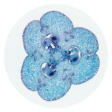 Lily Ovulary, General Structure, c.s., 12-20 µm Microscope Slide ...