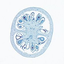 Tomato Fruit, c.s., 12 µm Microscope Slide | Carolina Biological Supply