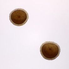 Gemmules, w.m. Microscope Slide | Carolina Biological Supply