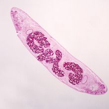 Clonorchis Sinensis Egg Slide